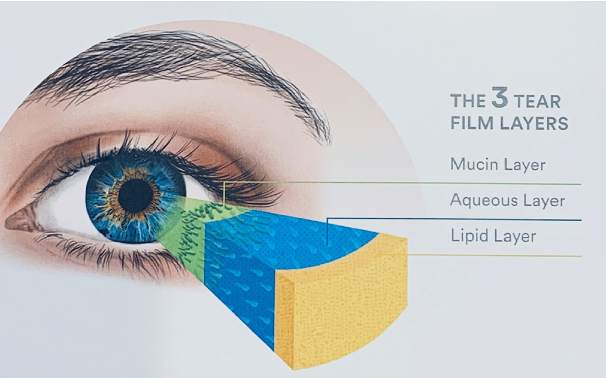 Dry Eye Disease Further Explained | Dry Eye Disease | Eye Health ...